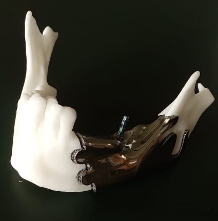 Bone-cutting robot receives CE certification | Robotics and Automation