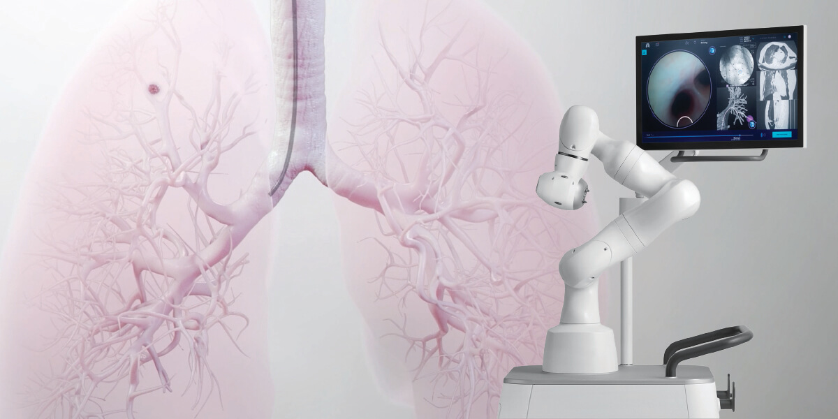 Noah Medical secures US$150m for robotic bronchoscopy solution ...