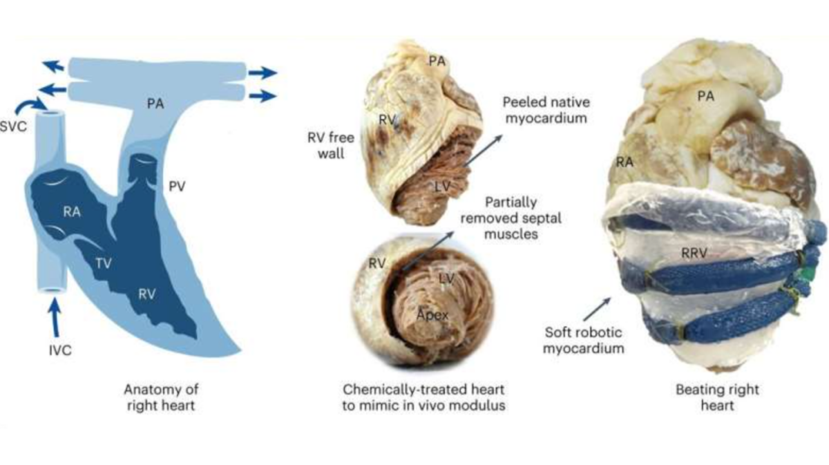MIT engineers build robotic replica of human heart's right ventricle ...